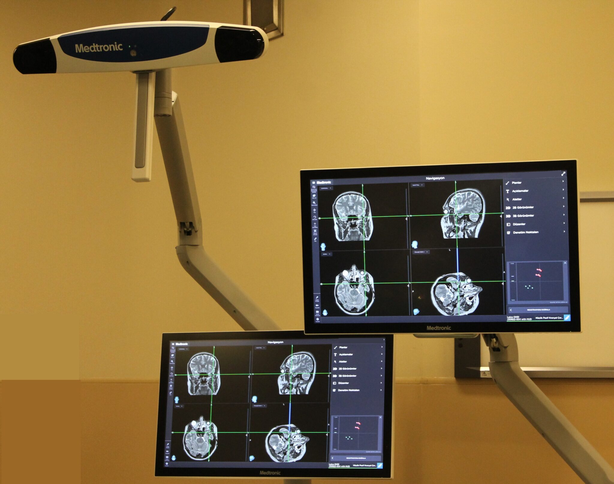 Advanced Neuro Navigation | Elmaci Neuro Neuronavigation